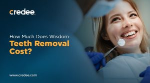 Wisdom Tooth Removal: Costs Without Insurance In 2025