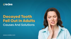 Causes And Solutions For Adult Tooth Loss Due To Decay