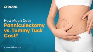 How Much Does A Panniculectomy vs. Tummy Tuck Cost In 2025?