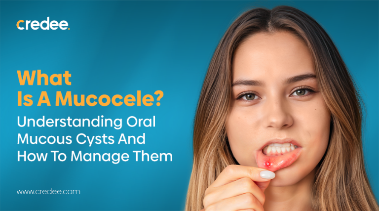 Mucocele: Causes, Symptoms, Treatment, And Payment Solutions